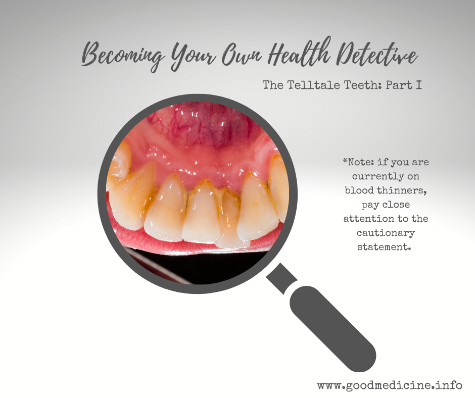 Health Clues in Your Teeth - Part 1 - Good Medicine